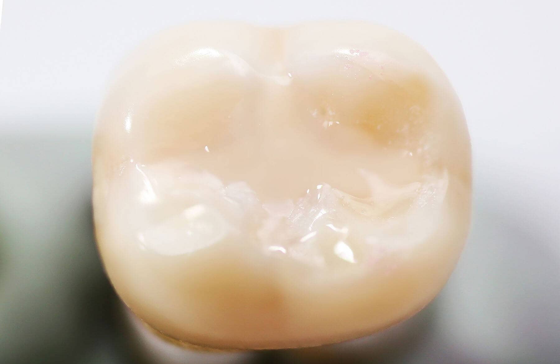 Dental Treatments & Post-Op Care • SORIdent